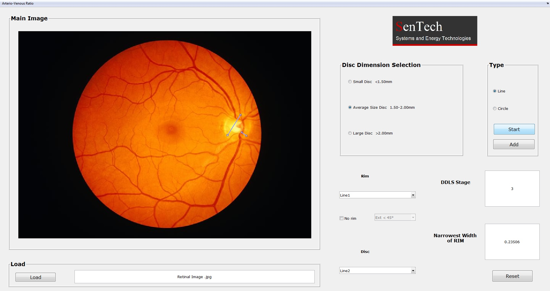 SenTech - Medical Image Processing
