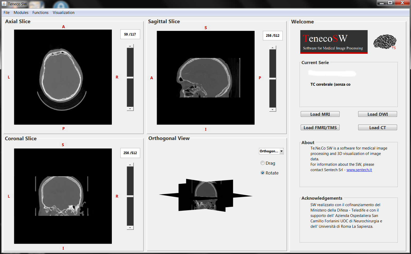 SenTech - Medical Image Processing